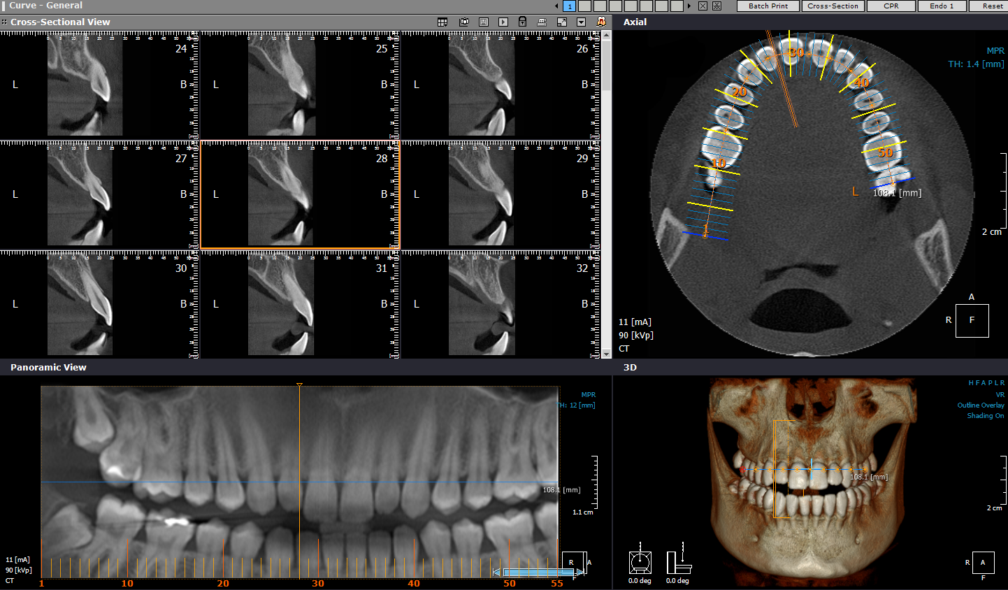 CBCT snimanje - Ardent Centar - Stomatološka ordinacija